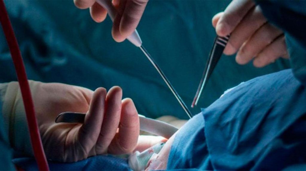 Realizaron el primer implante de marcapasos sin cable en Argentina ...